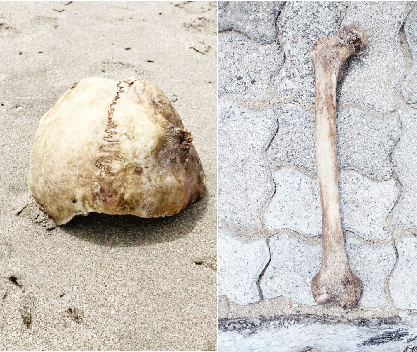 Restos óseos humanos aparecieron en las playas de Ostende